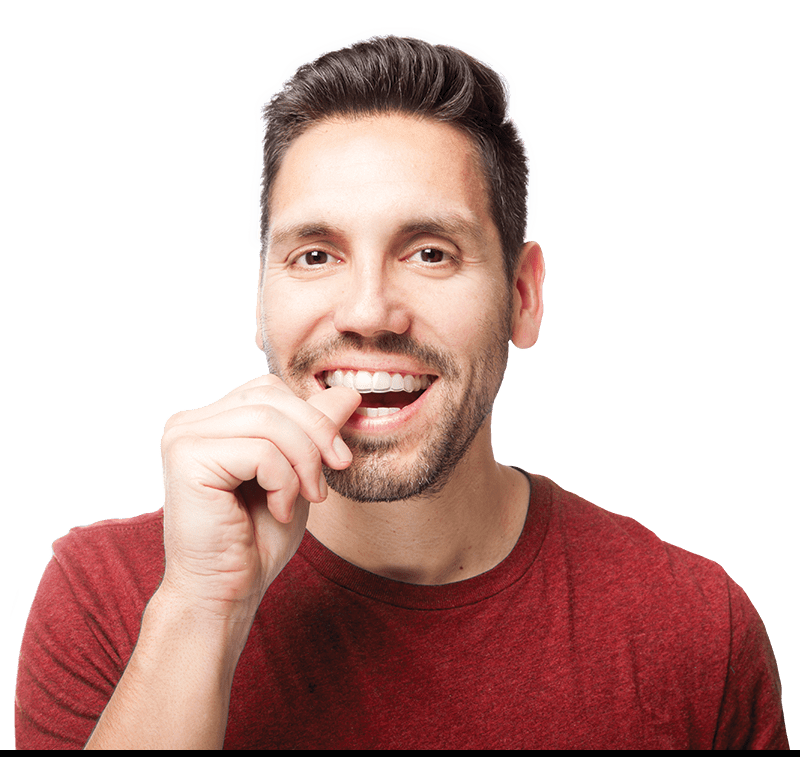 Ortho Retainers - DynaFlex