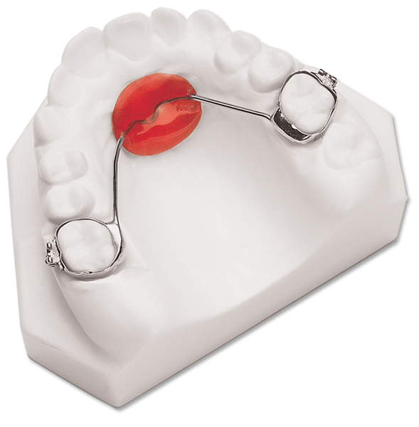Fixed Orthodontic Appliances - DynaFlex