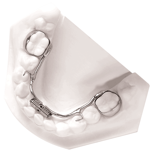 Fixed Expanders - DynaFlex