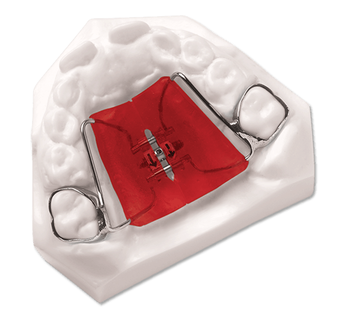 Fixed Expanders - DynaFlex