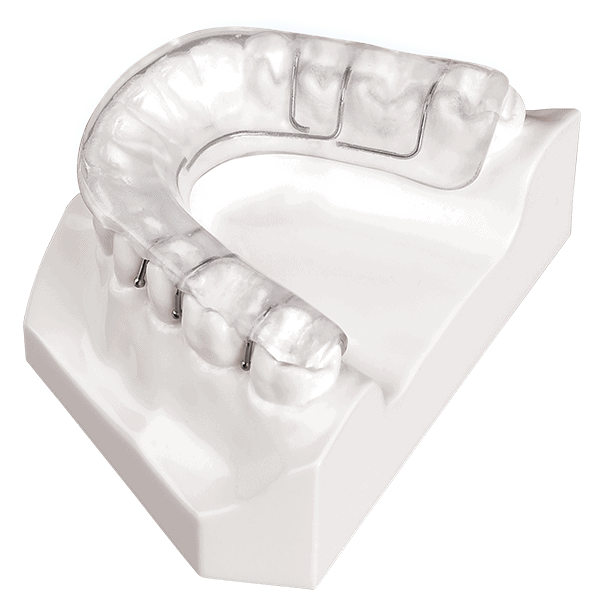 Orthopedic Splints - DynaFlex