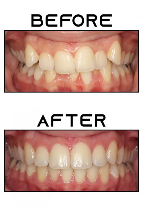 The Norris System - DynaFlex