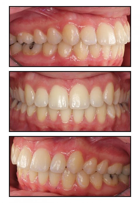 The Norris System - DynaFlex