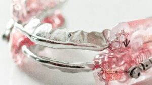 Respire Pink EF AT (Advanced Titration) - DynaFlex