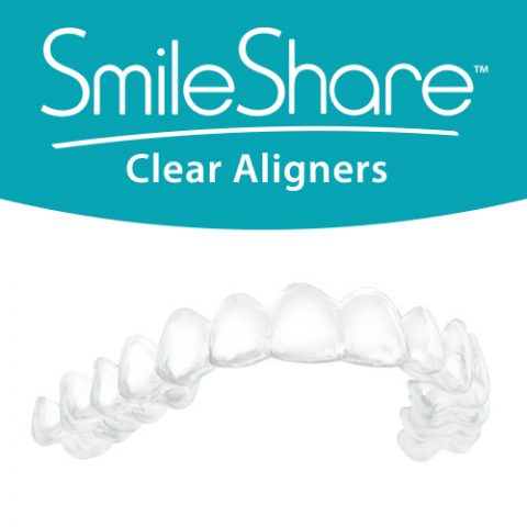 SmileShare™ Clear Aligners - DynaFlex