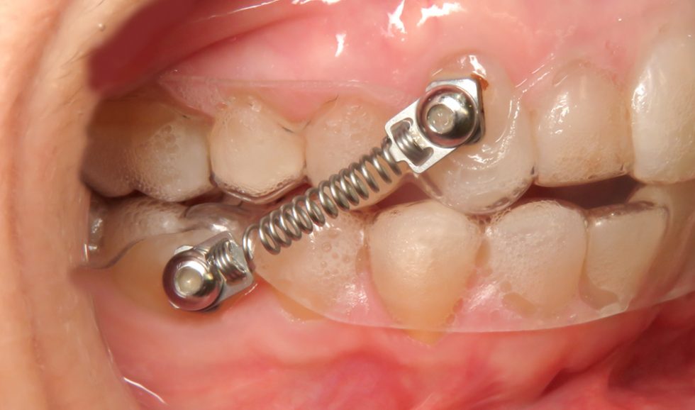 CS5 Bondable - DynaFlex