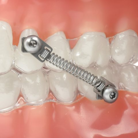 CS System Class II and Class III Corrector - DynaFlex