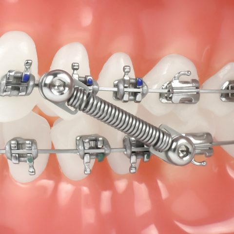 CS System Class II and Class III Corrector - DynaFlex