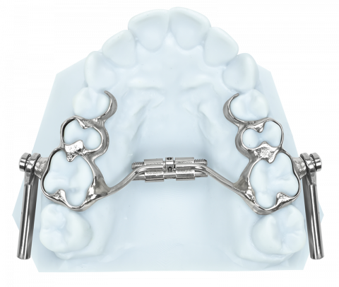 Herbst Orthodontic Appliance - DynaFlex