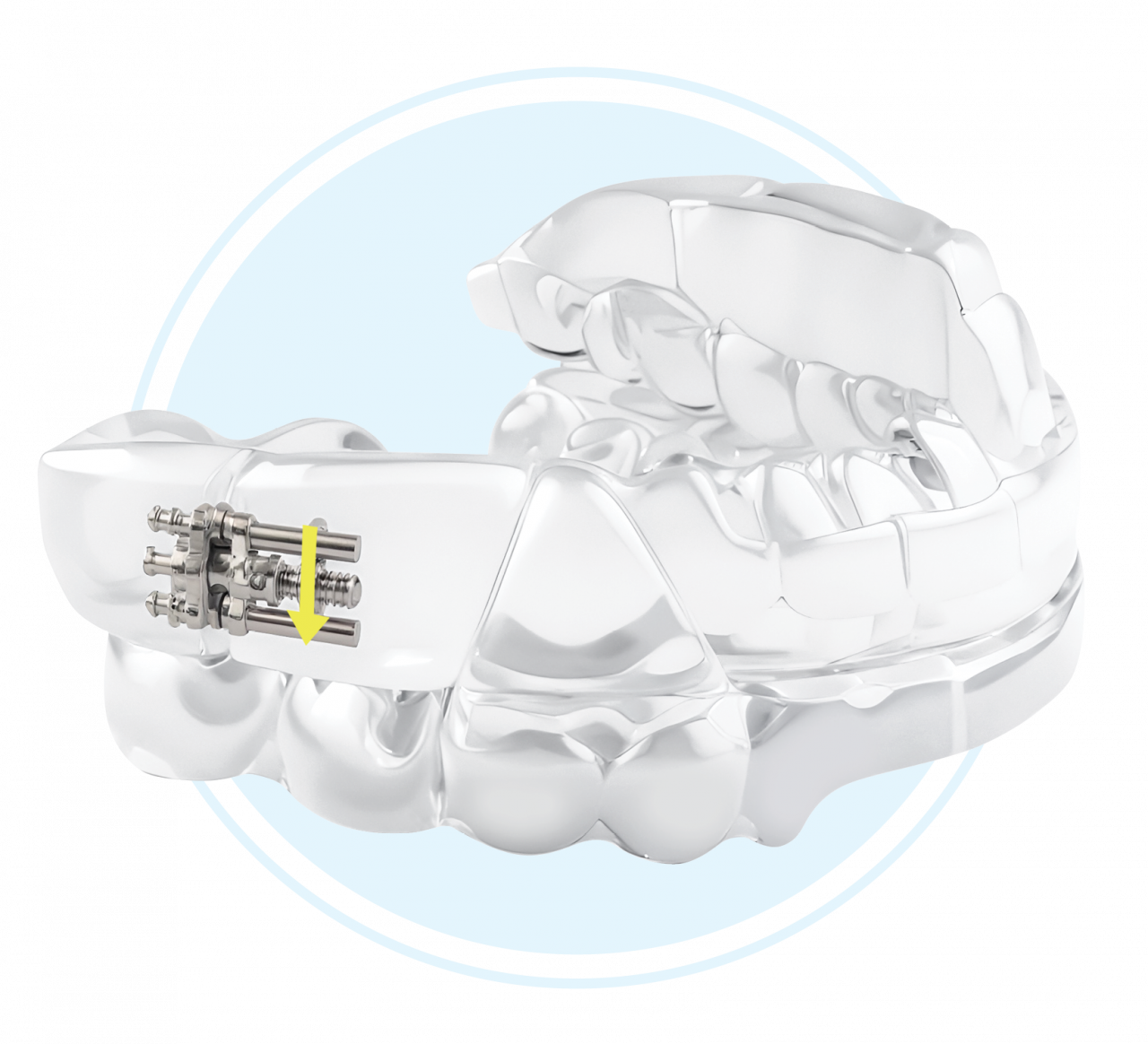 DynaFlex Dorsal - DynaFlex